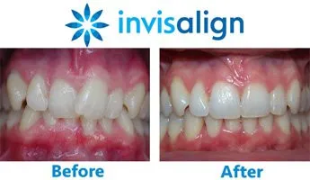 Dentist Washington DC | Cosmetic Dentistry